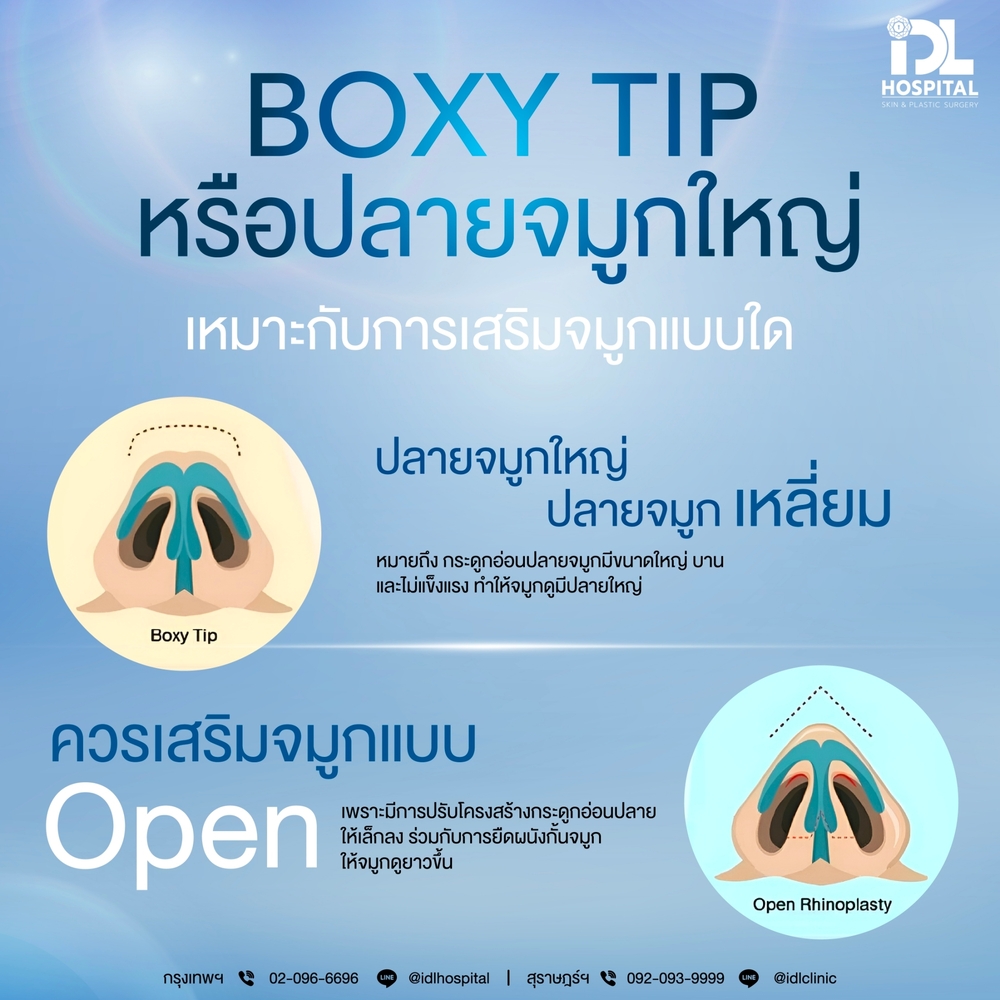 BOXY TIP หรือปลายจมูกใหญ่เหมาะกับการเสริมจมูกแบบใด ? - IDL HOSPITAL